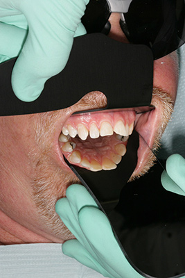 PhotoMed Contrasters